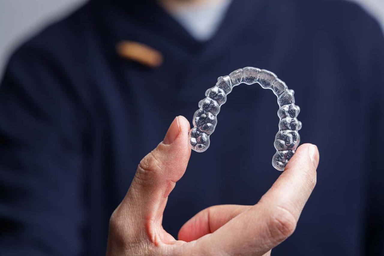Candid Clear Aligners Cost | Dentist in Houston Midtown TX