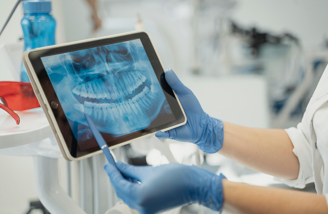 Tooth Pain Relief Houston - Emergency Dental Care